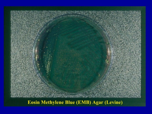 Enterobacteriaceae | PPT | Digestive Disorders | Diseases and Conditions