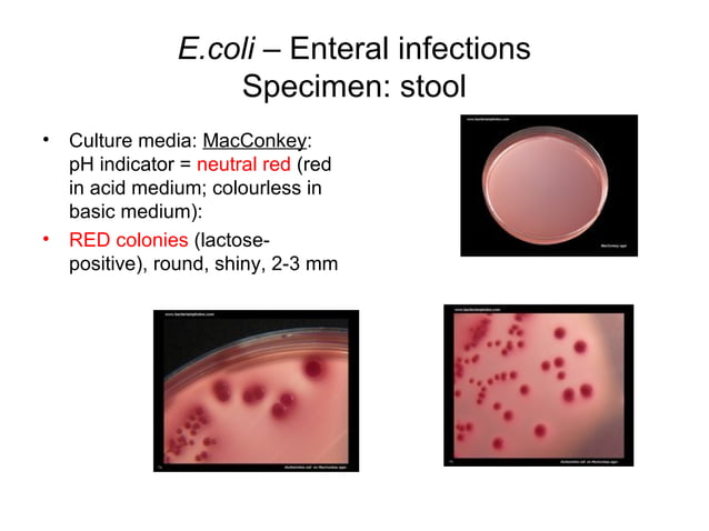 Enterobacteriaceae | PPT | Digestive Disorders | Diseases and Conditions
