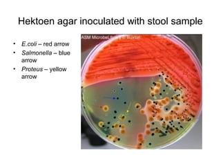 Hektoen Enteric Agar Positive Result