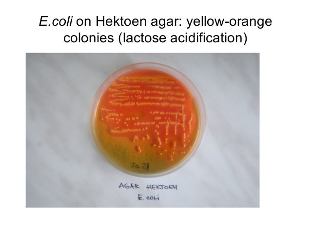 Hektoen Enteric Agar Positive Result