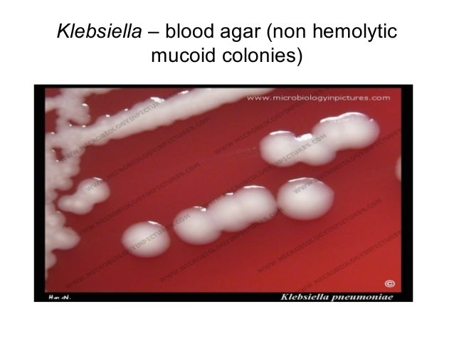 Growth Of Klebsiella Oxytoca On Cled Agar Plate This