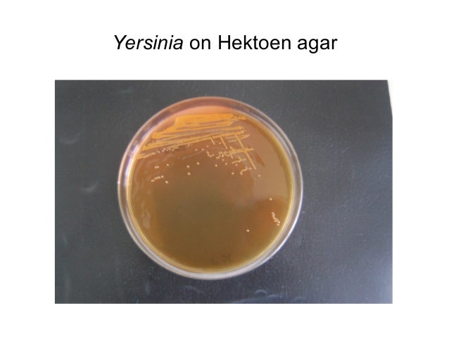 Enterobacteriaceae