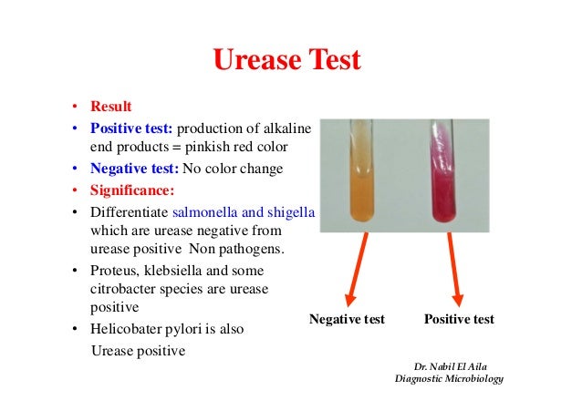What Is Urease Test Principle Composition