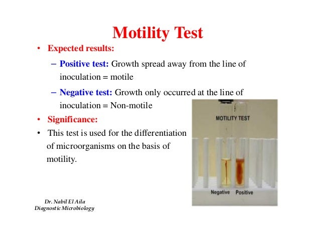Enterobacteriacea i biochemical reaction بكتريا عملي