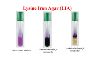 Lysine Iron Agar