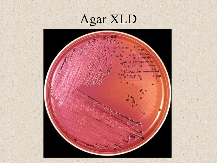 Xld Agar Yersinia Entercolitica
