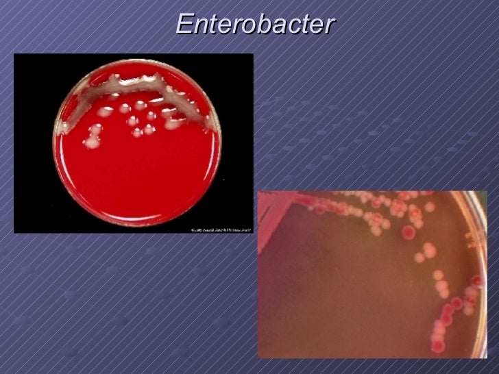 Enterobacter Aerogenes Macconkey Agar