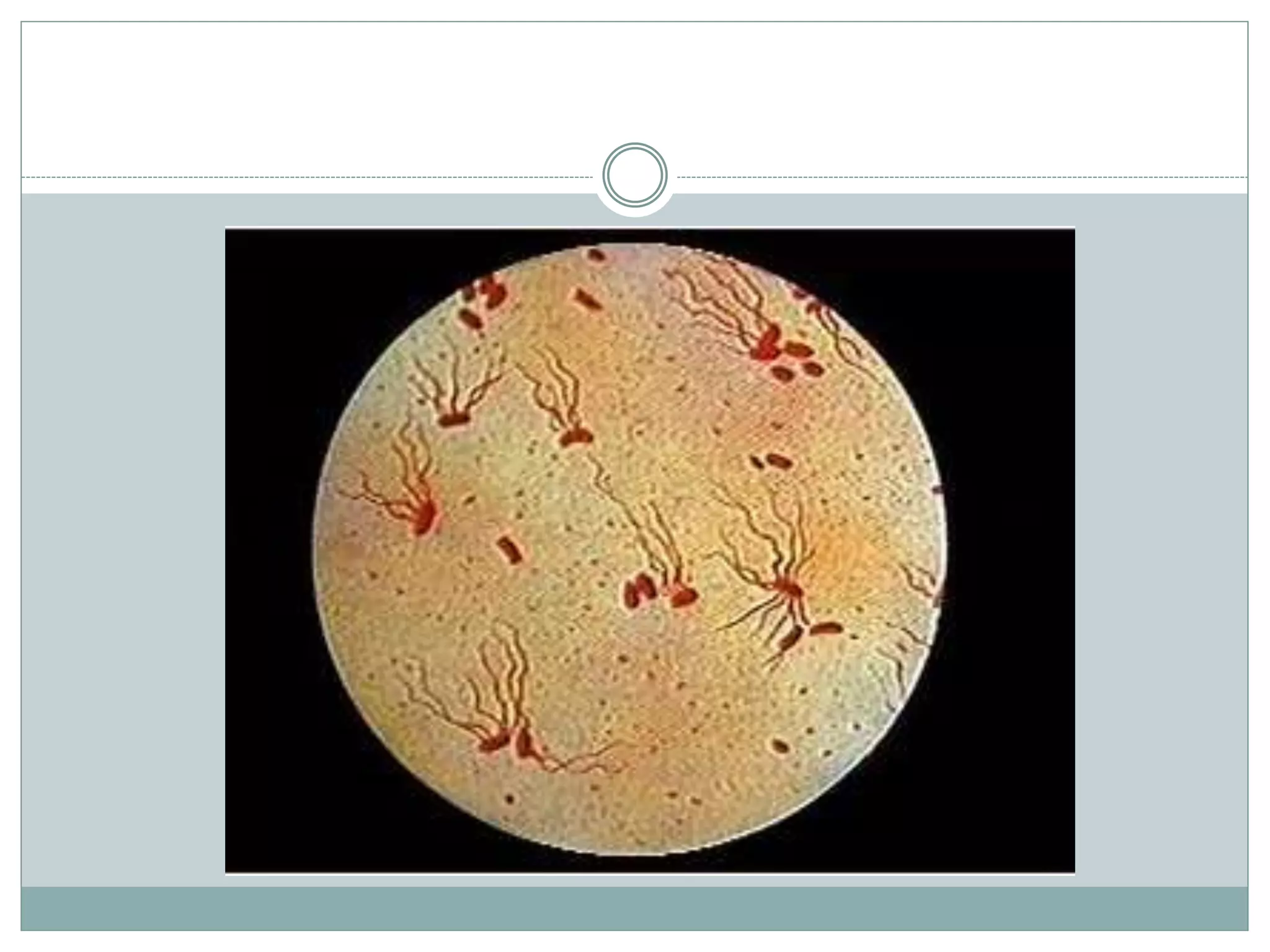 Enterobacter, serratia, salmonella, klebsiella, shigella y proteus ...
