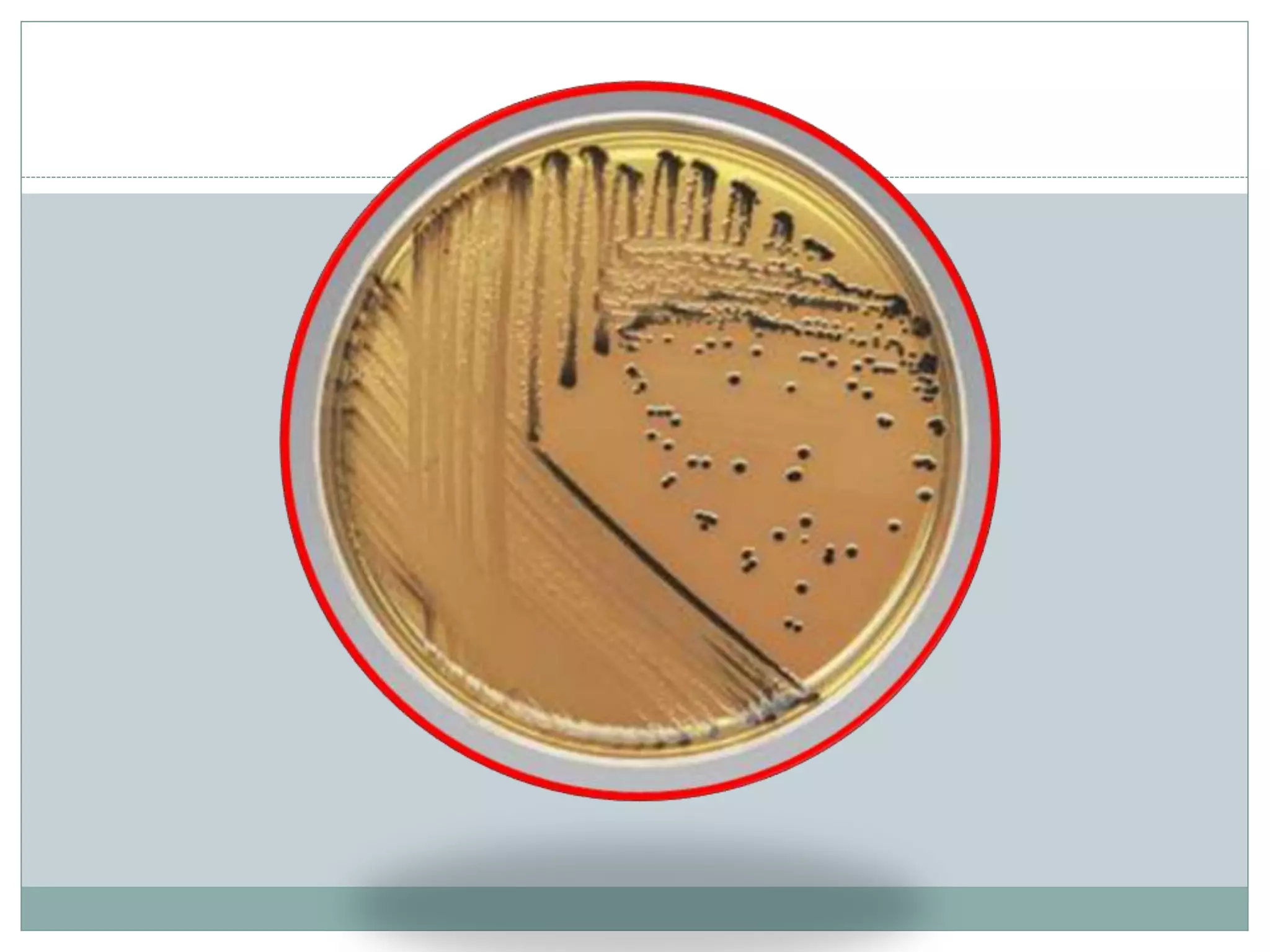 Enterobacter, serratia, salmonella, klebsiella, shigella y proteus ...