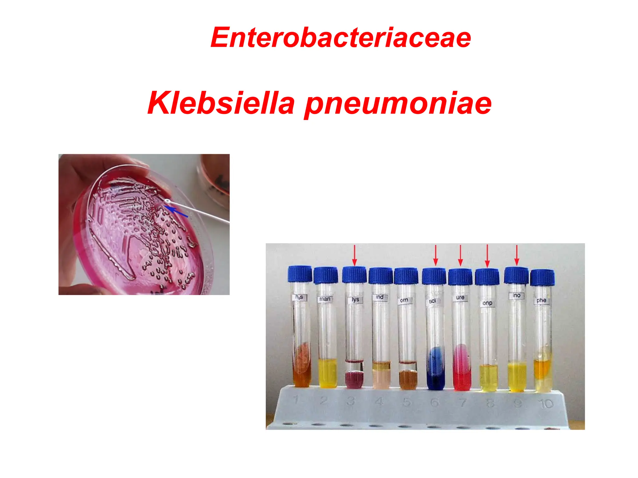 Enterobakteria......................pptx