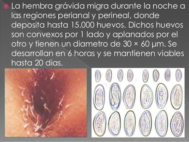 Enterobiasis u Oxiuriasis