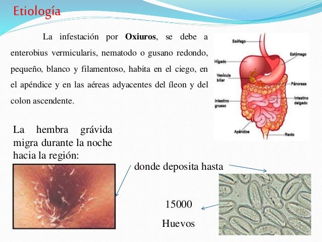 Enterobiasis u osuriasis