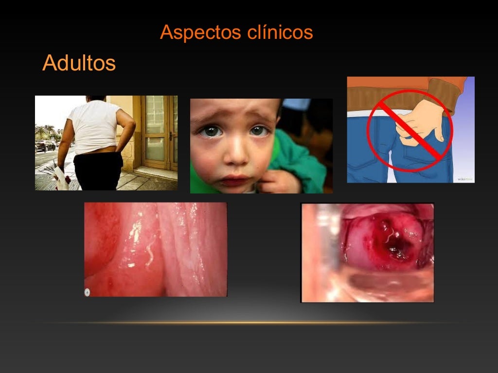 Enterobiasis u Oxiuriasis Dr. Gutierrez