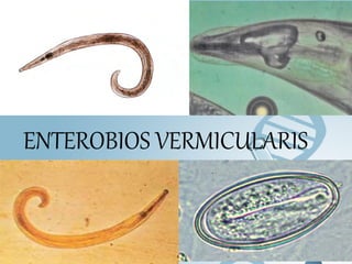 7.0 Enterobius vermicularis | PDF