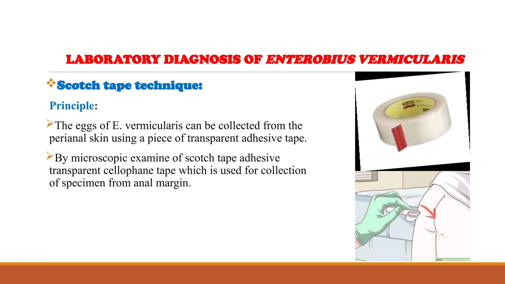 Enterobious vermacularis.pptx Manoj Mahato | PPTX