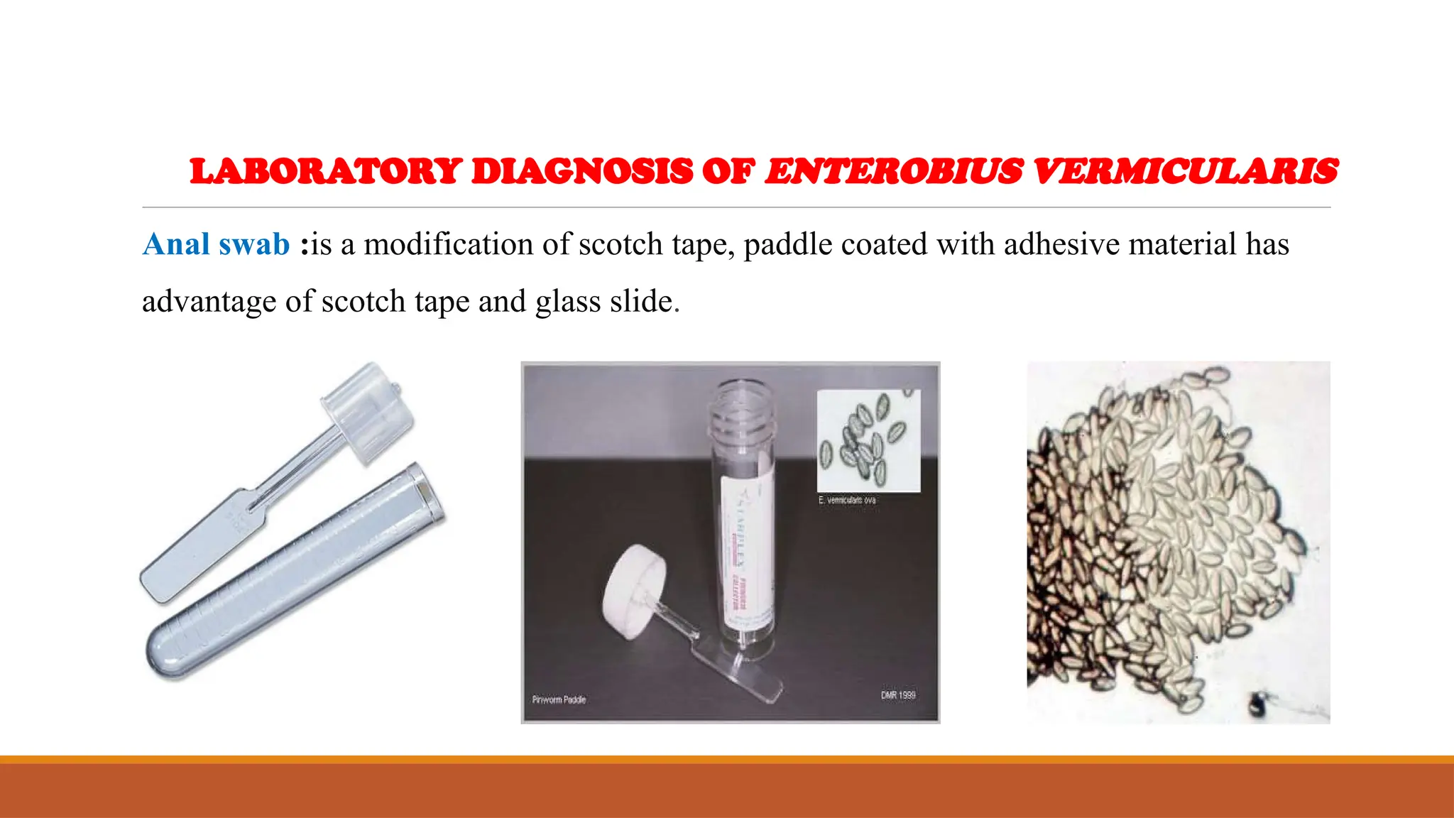 Enterobious vermacularis.pptx Manoj Mahato | PPTX