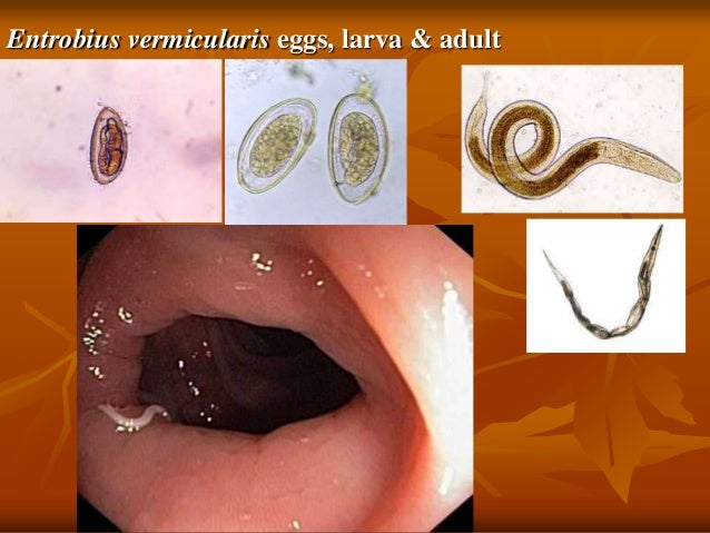 Enterobius vermicularis