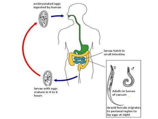 Enterobius and trichuris trichura | PPTX