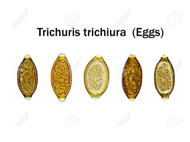 Enterobius and trichuris trichura | PPTX | Digestive Disorders ...