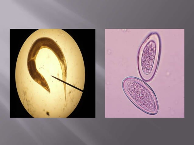 Enterobius vermicularis(PINWORM) | PPTX | Infectious Diseases ...