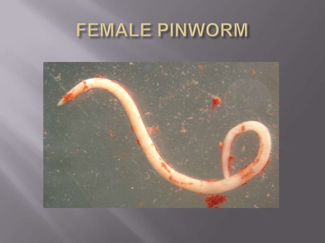 Enterobius vermicularis(PINWORM) | PPTX | Infectious Diseases ...