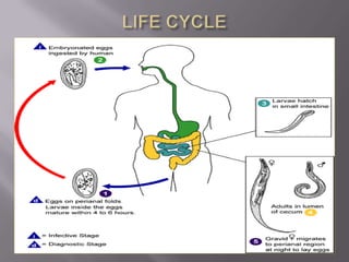 Enterobius vermicularis(PINWORM) | PPTX
