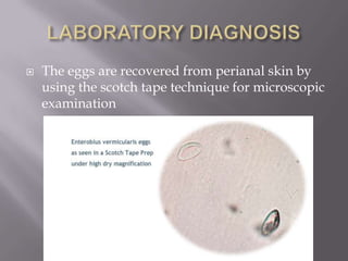 Pinworm Scotch Tape Test