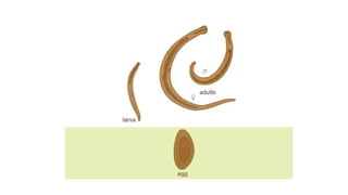 Enterobius vermicularis | PPTX