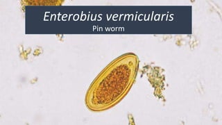 Enterobius Slide