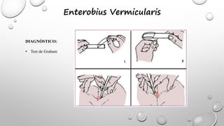 Enterobius vermicularis.ppt