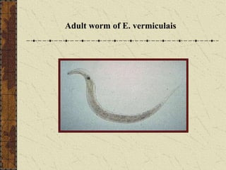 Parasitology Enterobius vermicularis.ppt