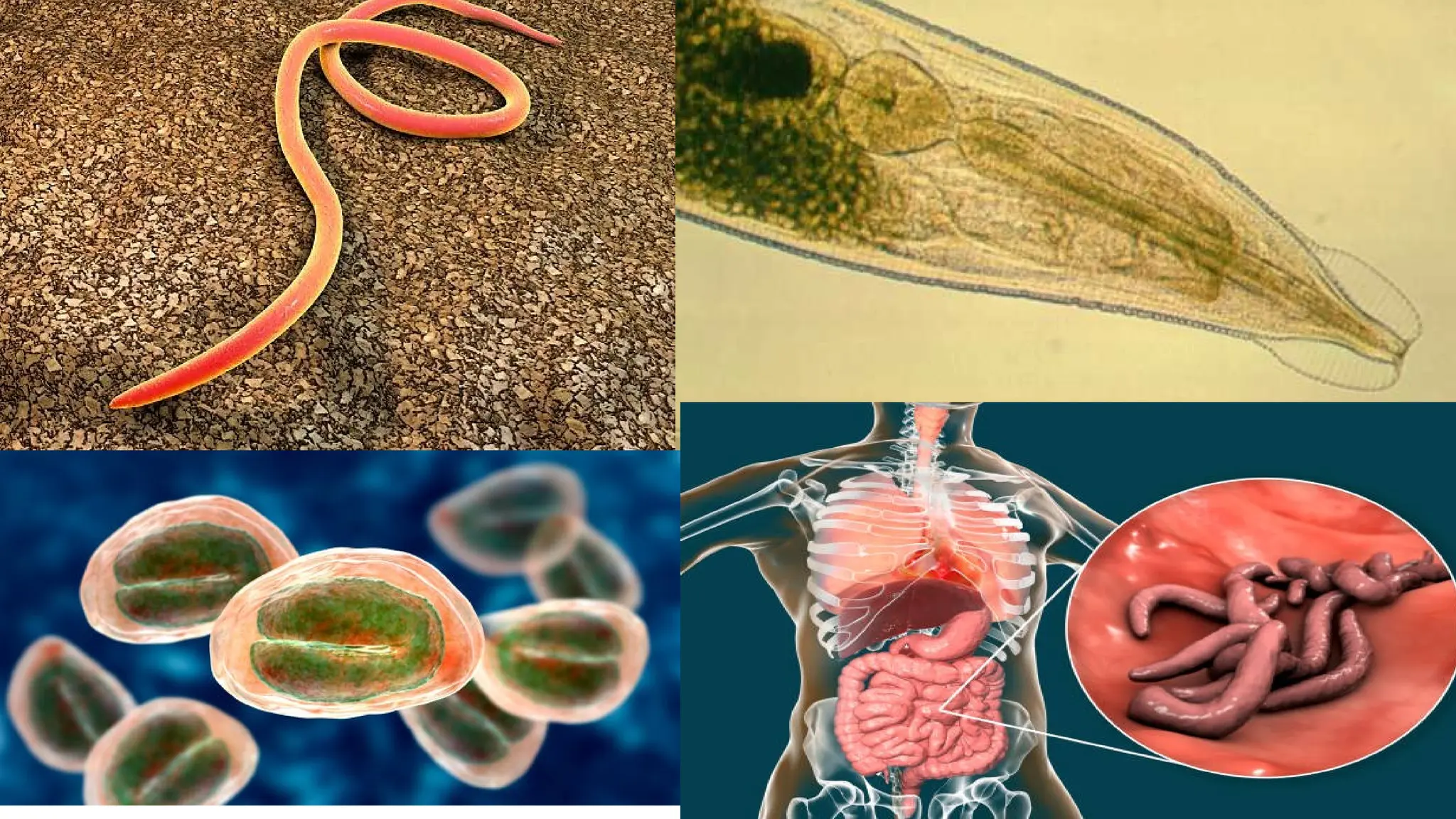 ENTEROBIUS VERMICULARIS endoparasite.pptx
