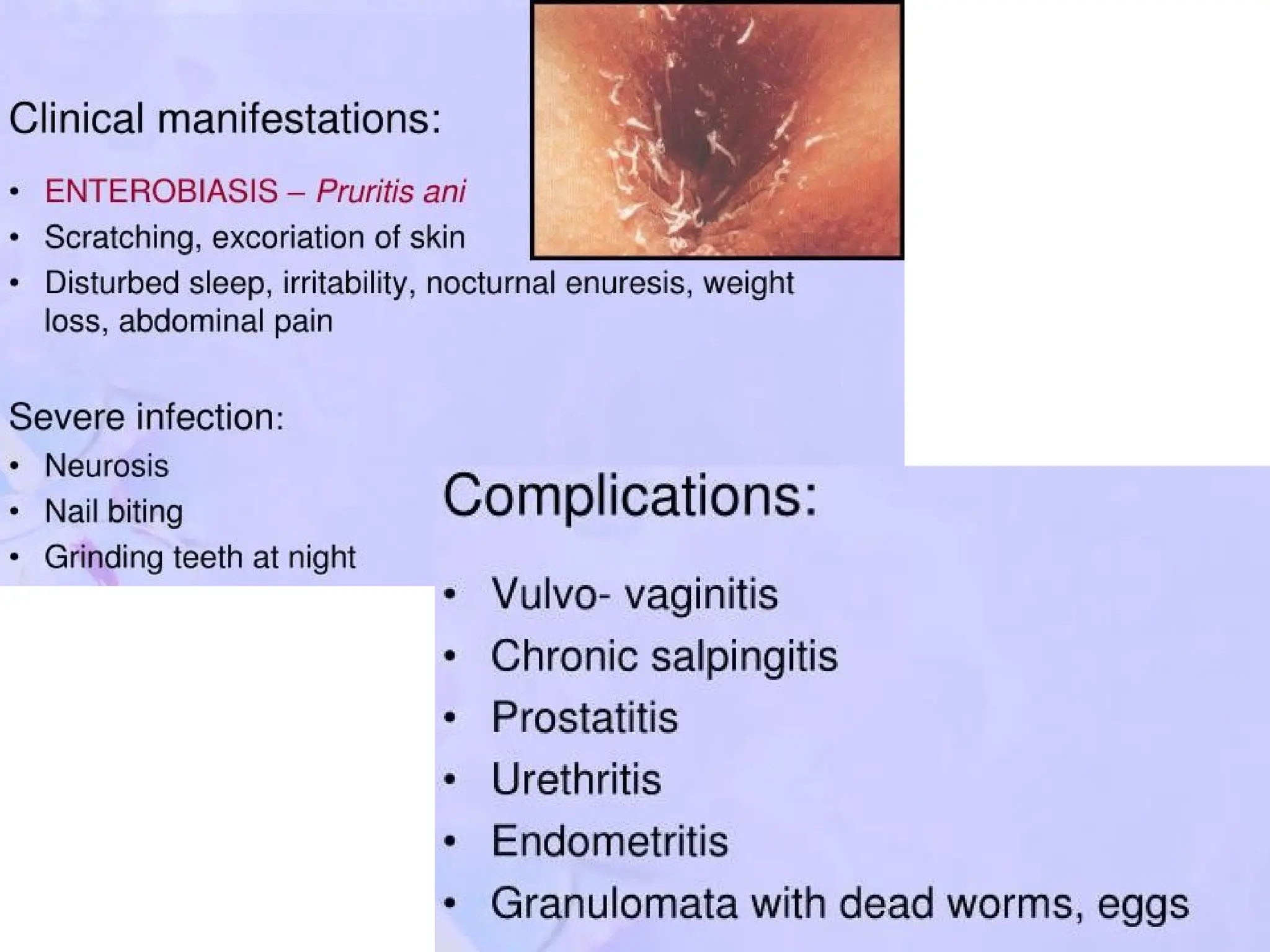 ENTEROBIUS VERMICULARIS. Human parasitic infection and its health ...