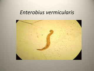 Enterobius Vermicularis Larvae
