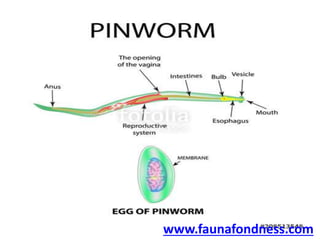 Enterobius Vermicularis Slide