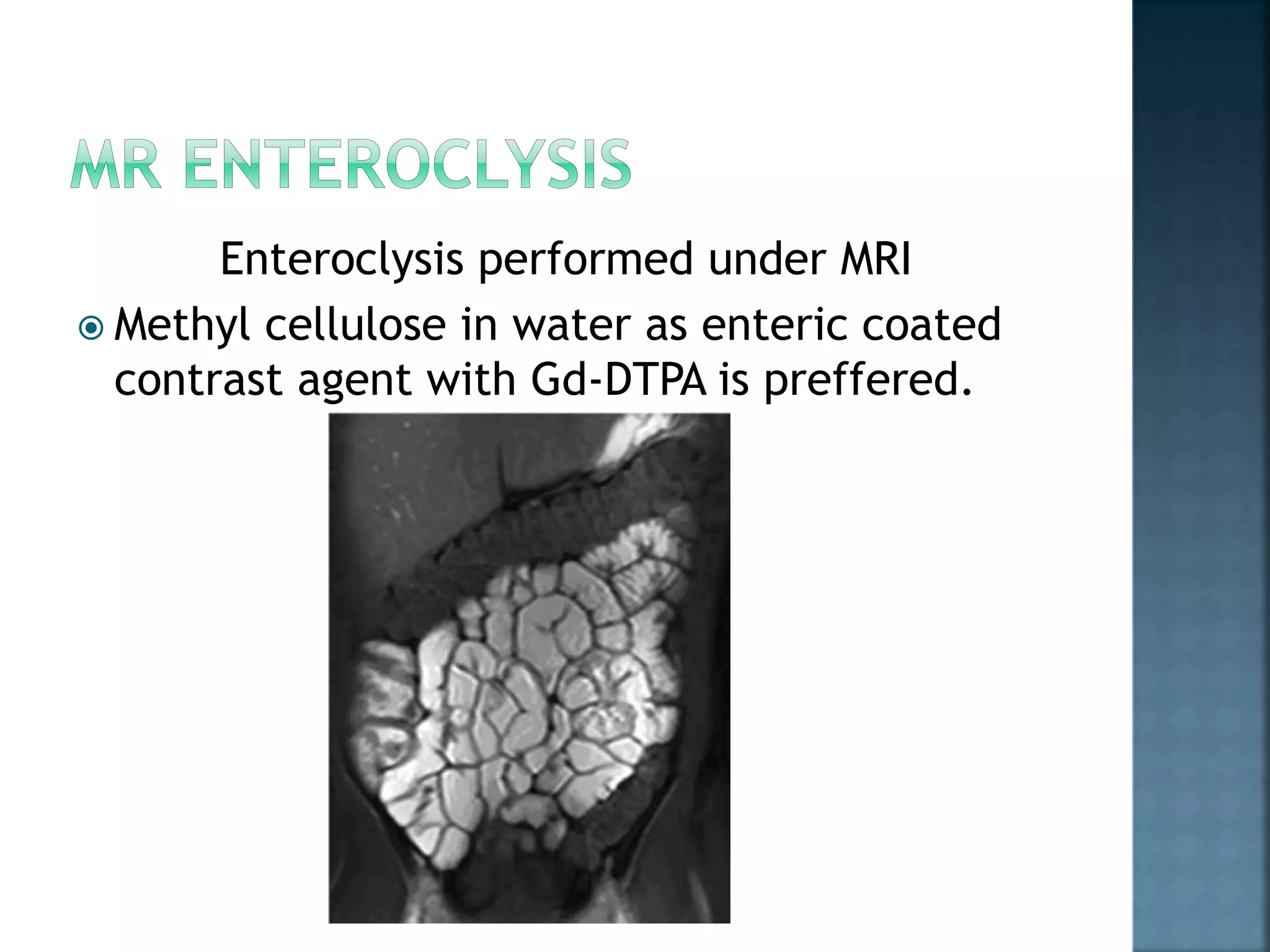Enteroclysis | PPTX