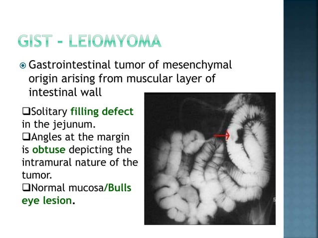 Enteroclysis | PPTX | Digestive Disorders | Diseases and Conditions
