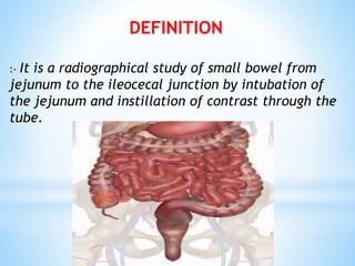Enteroclysis( small bowel enema) | PPTX