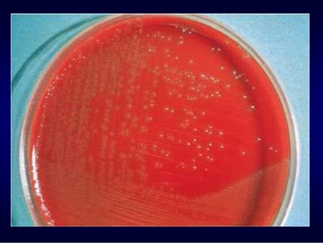 Enterococcus Urine Culture