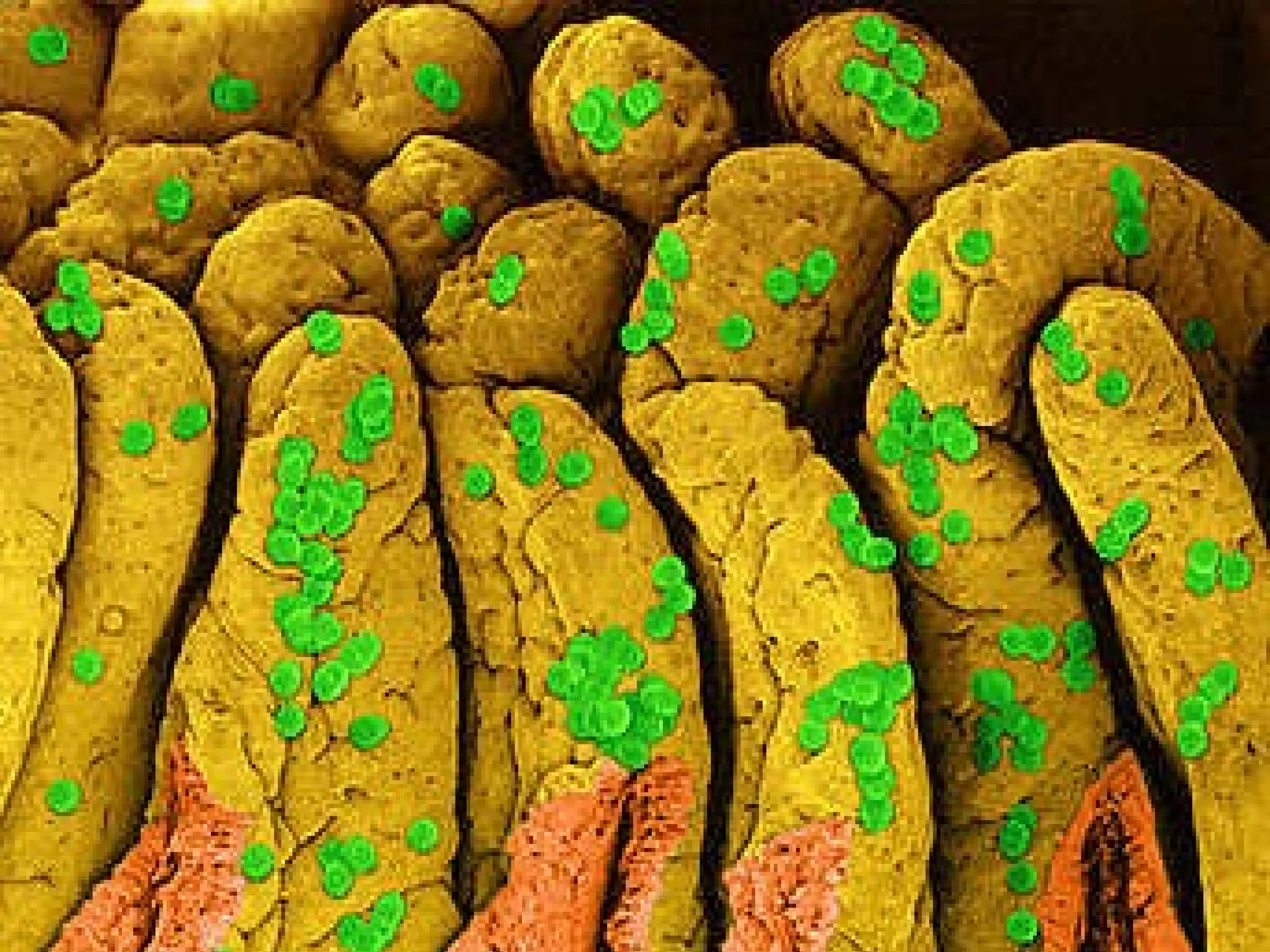 Enterococcus Faecium | PPT