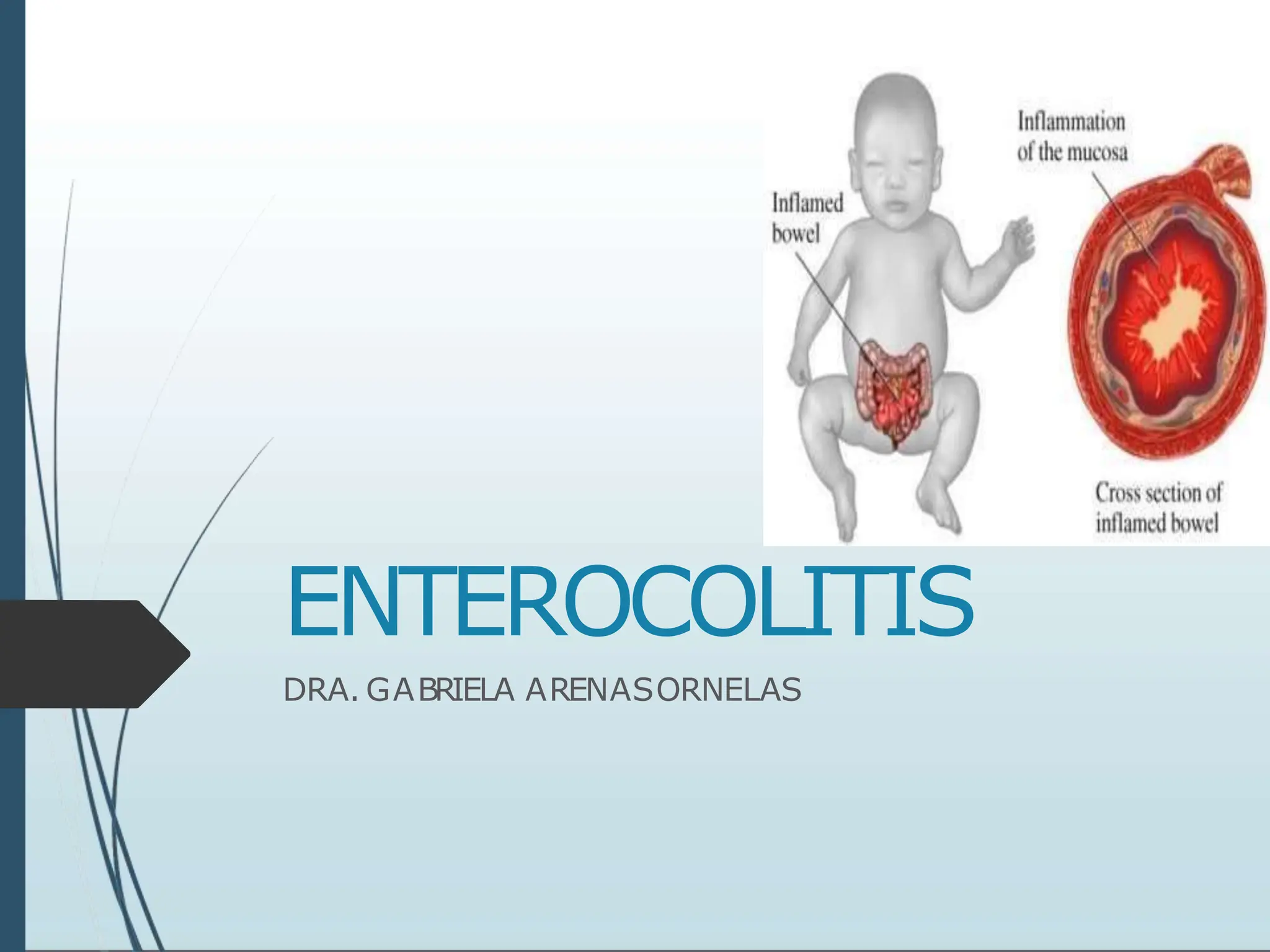 enterocolitis-140217052855-phpapp01.pptx