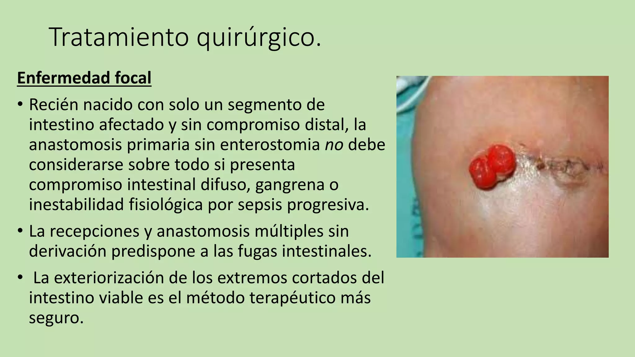 Enterocolitis | PPTX