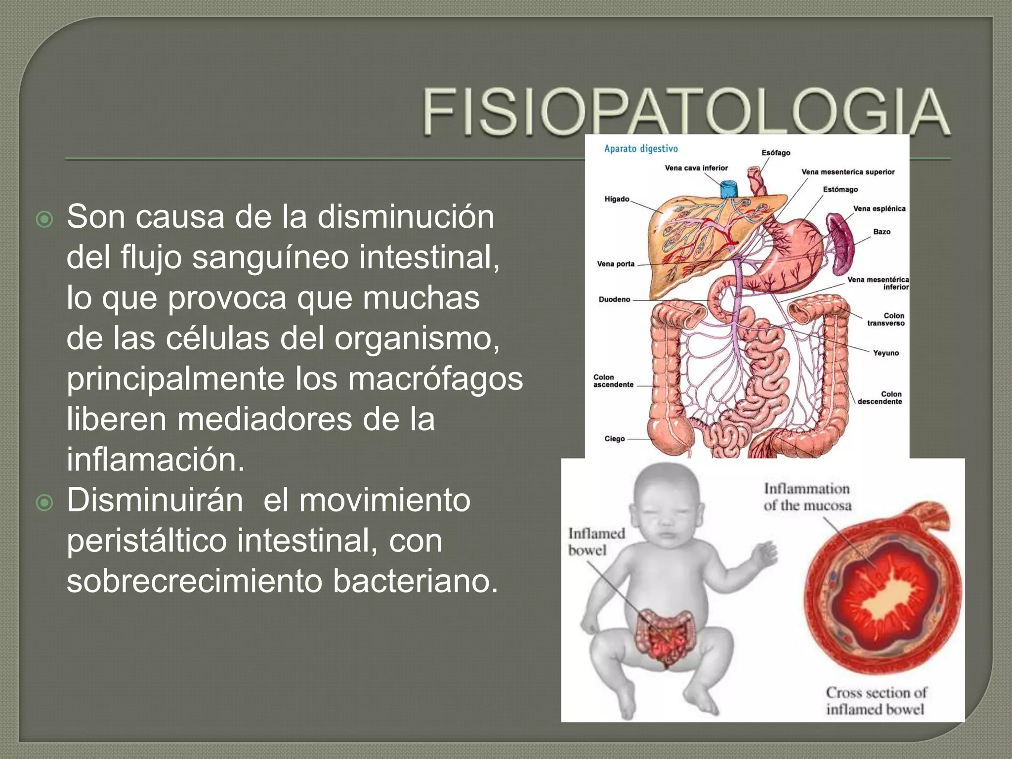 Enterocolitis necrosante | PPTX | Digestive Disorders | Diseases and ...