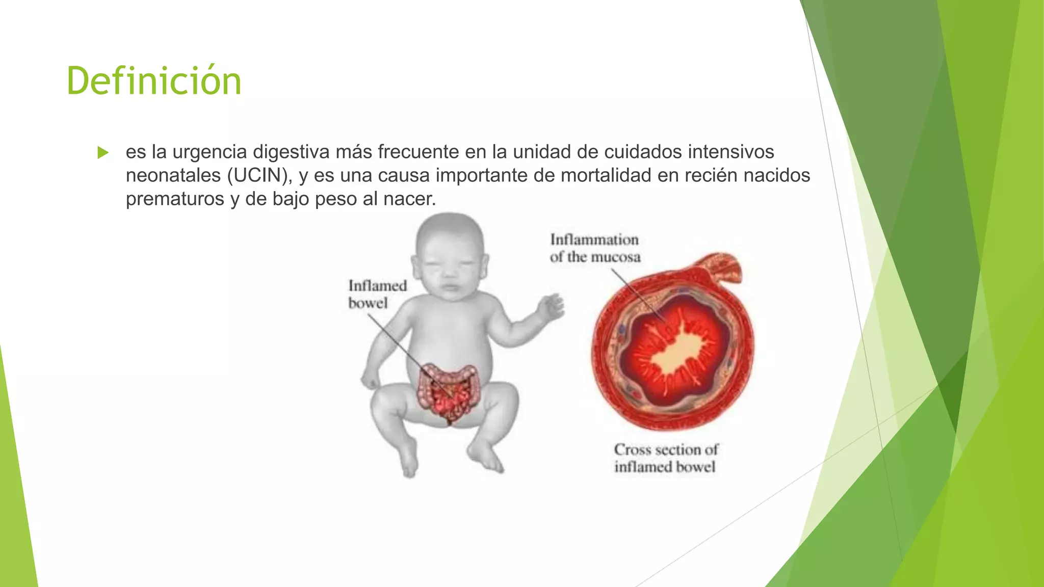 enterocolitis necrosante .pptx