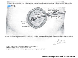 Enterocutaneous fistula | PPTX