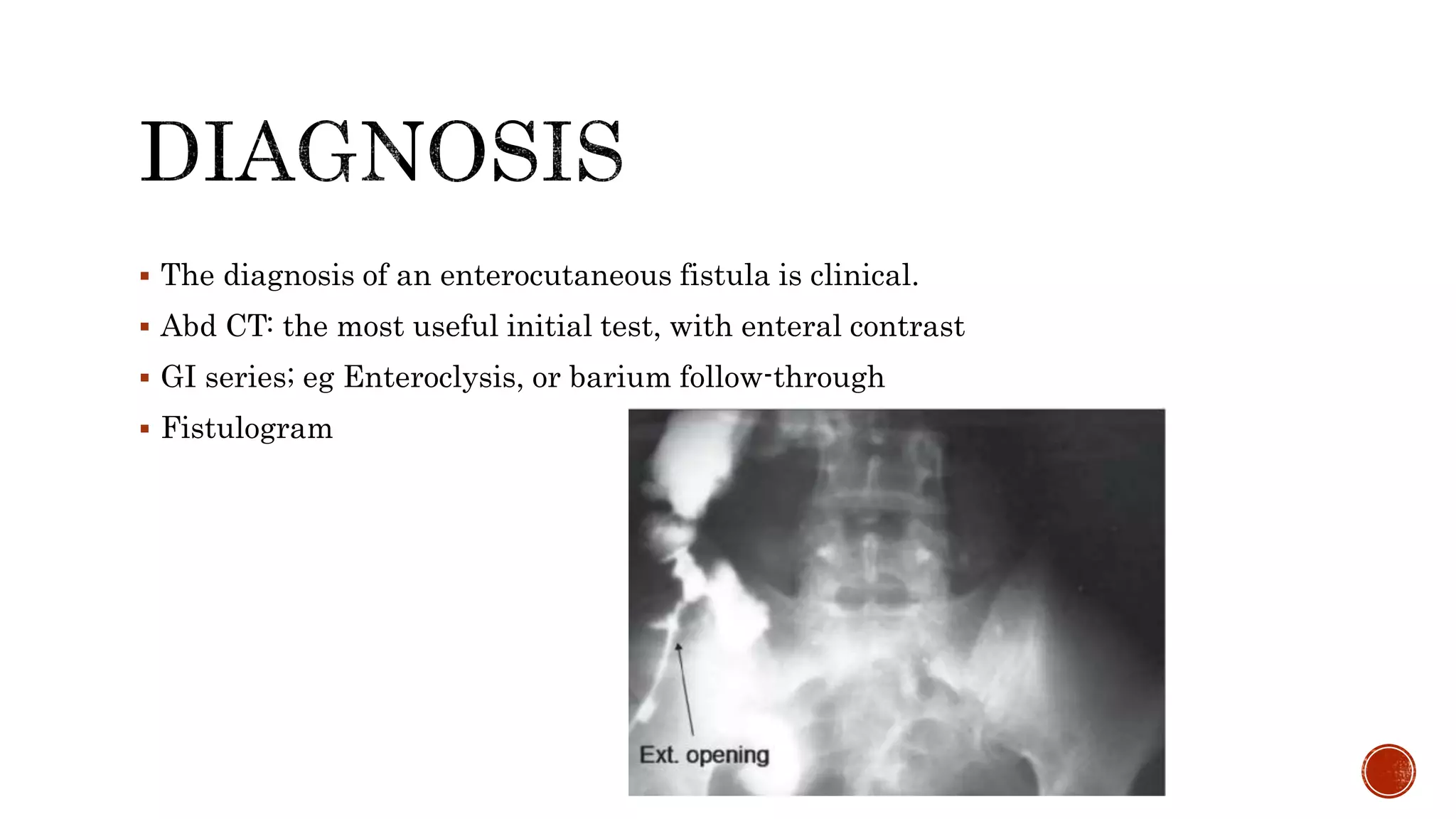 Enterocutaneous fistula | PPTX