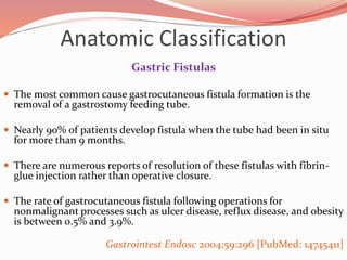 Enterocutaneous Fistula (general surg).pptx
