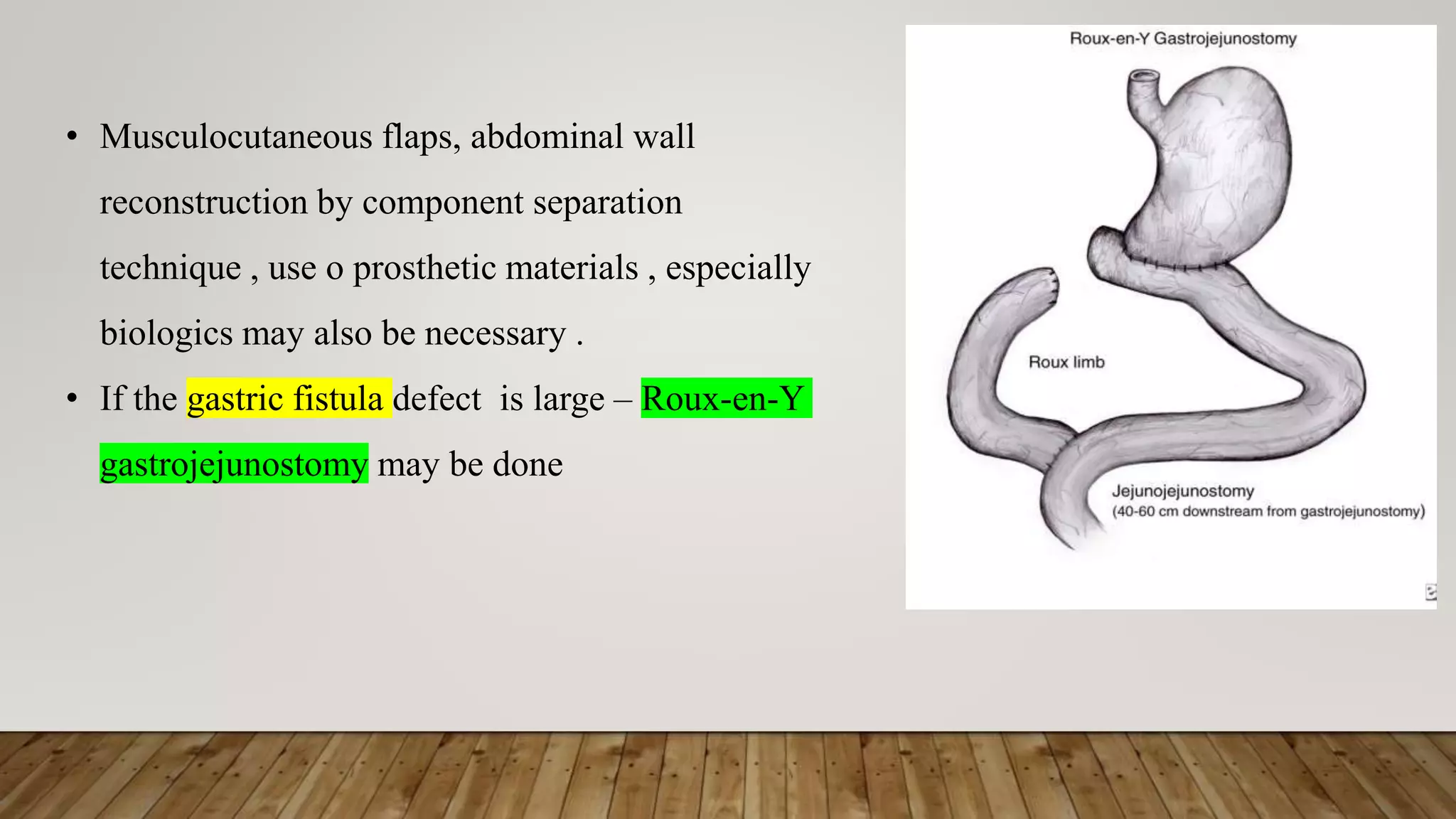 Enterocutanoeus fistula | PPTX