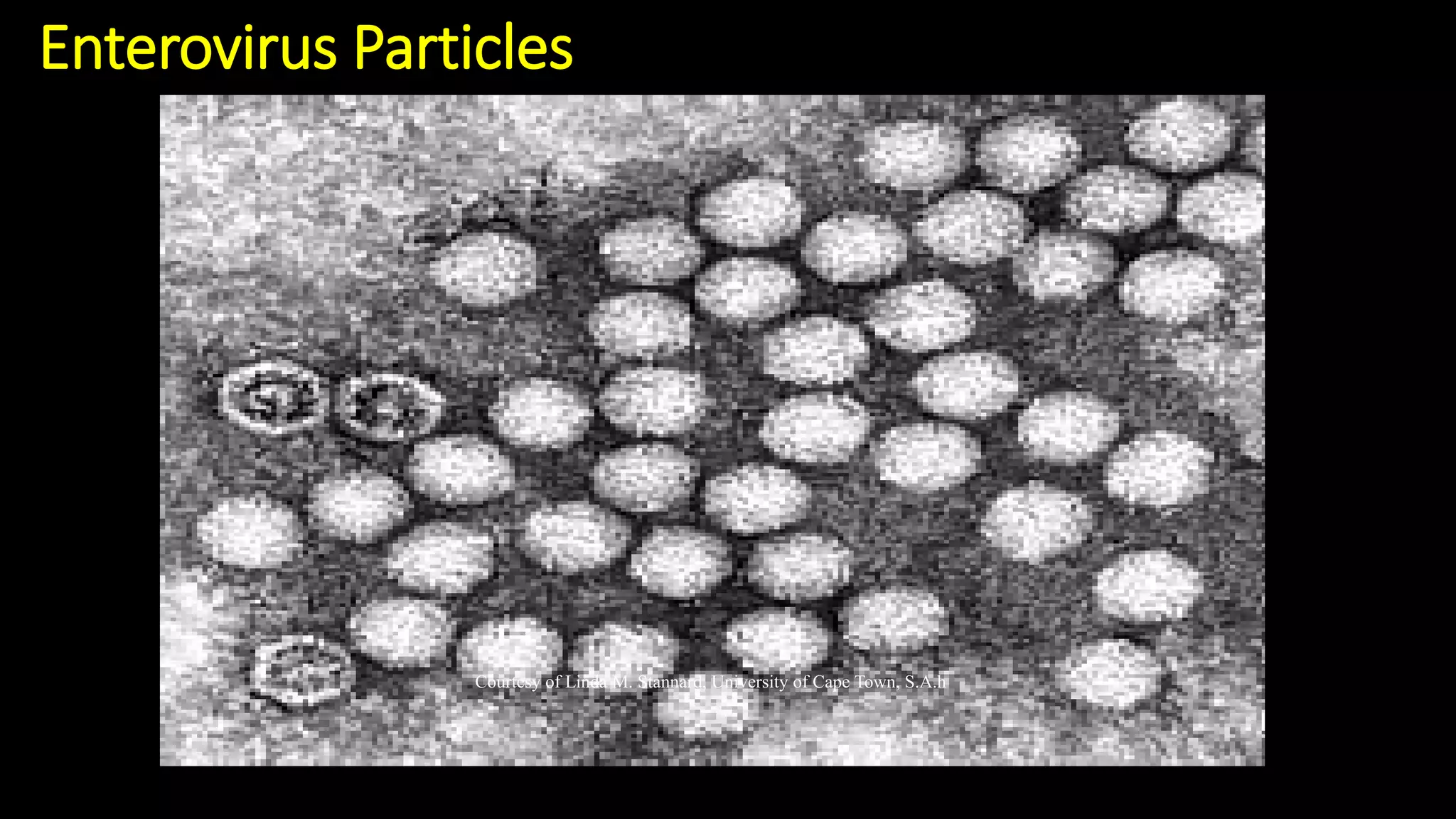 Enteroviruses-1(0).pdf
