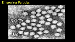 Enteroviruses-1(0).pdf